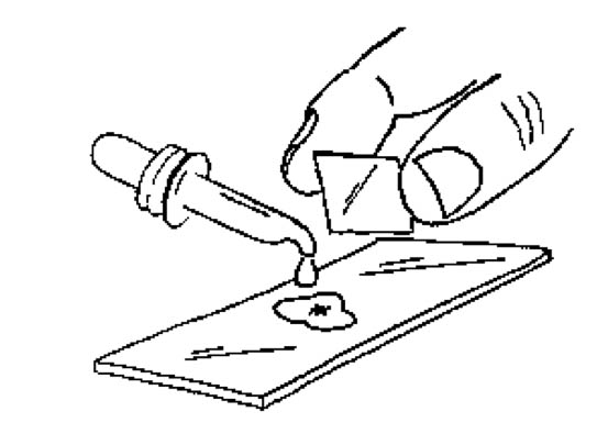 Tricogramma - TricoItalia